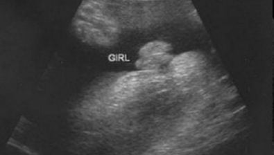 What To Expect When You're 36 Weeks Pregnant | MomTricks