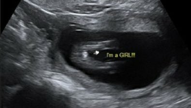 What To Expect When You're 13 Weeks Pregnant | MomTricks